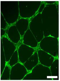 Endothelial Colony Forming Cells